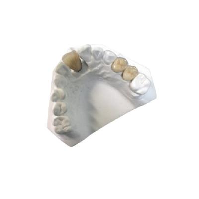 Cina Stato ad alta resistenza dell'OEM della corona dentaria della porcellana dell'oro giallo nuovo in vendita