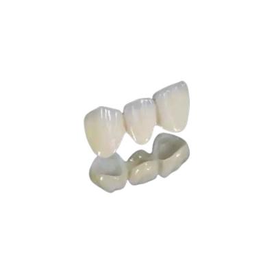 China Fit Properly Dental Crown Bridge Single Ended Fixed Bridge Crown for sale