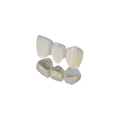 China Wear Natural Crown Bridge Teeth Titanium Alloy Single Ended Fixed Bridge Crown for sale