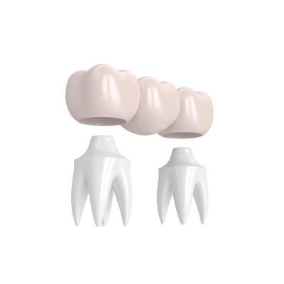 Cina Ponti realistici di aspetto e colore naturale stabilità dentaria delle corone di forte in vendita