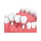 Китай Удобное зубоврачебное сопротивление носки крон и мостов сильное делает улыбку сладкий продается