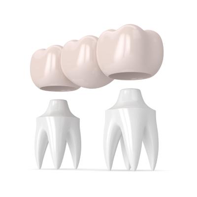 All-Ceramic Crown Appearance And Hardness Closest To Real Teet Transparent Gloss