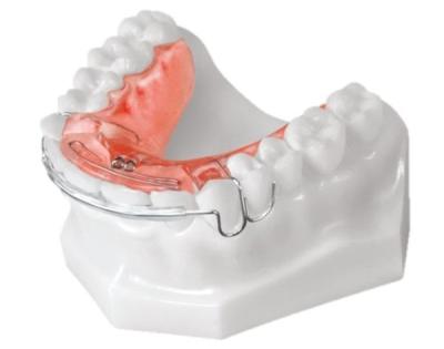 China Dental Orthodontic Appliances Simple Install HighTech Biological Material for sale
