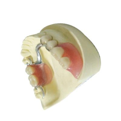 China Custom Made Dental Lab Products Polymer Removable Partial Dentures for sale