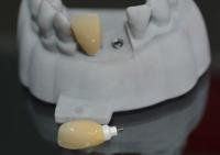 China Corrosion Resistant CAD PEEK Custom Abutment Designed To Improve Implant Longevity And Patient Comfort In Dental Treatments for sale