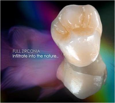 Cina Parte sovrapposto in rilievo dentario dell'intarsio dell'impiallacciatura della corona di biossido di zirconio Tutto ceramico di FDA 3014652903 in vendita