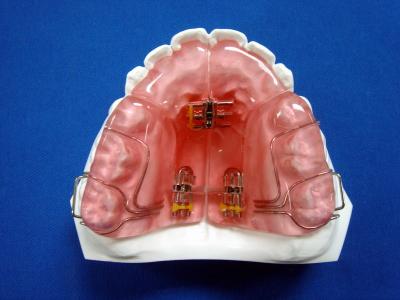 China Custom Removable OEM Fixed Orthodontic Appliance Good Durability for sale