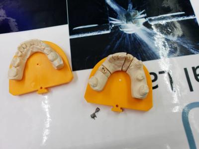 Cina Materiale biologico alta tecnologia del metallo PFM del ponte dentario pieno della corona in vendita