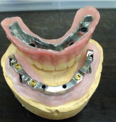 Cina Impianto dentario di sicurezza del laboratorio dell'alta inter protesi dentaria biologica di miscibilità in vendita