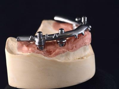 Cina L'impianto di titanio di CNC All-On-4 ha fissato le protesi dentarie per la clinica dentaria in vendita