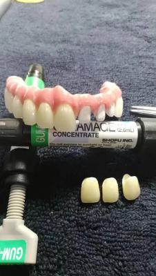 Cina Corona dentaria smontabile del singolo titanio flessibile per la clinica dentaria in vendita
