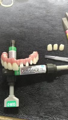 Cina Corona dentaria smontabile del singolo titanio flessibile per la clinica dentaria in vendita