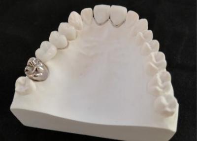 Cina Resistenza della corrosione completa su misura del metallo della corona dentaria della porcellana di PFM in vendita