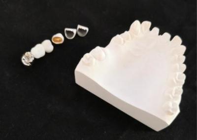 Cina Resistenza della corrosione completa su misura del metallo della corona dentaria della porcellana di PFM in vendita