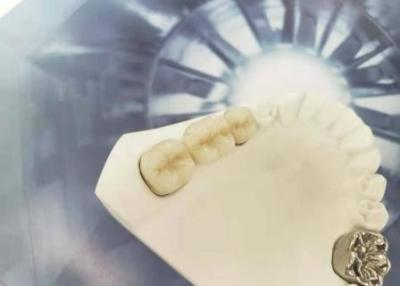 Cina Corona dentaria di lucidatura alto Intermiscibility biologico della porcellana dell'OEM in vendita