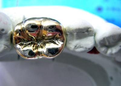 China High Stability Semi Precious Dental Crown Bridge PFM Easy Casting for sale