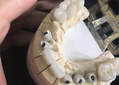 Cina Biocompatibilità eccellente delle corone dentarie bianche libere di biossido di zirconio del metallo in vendita