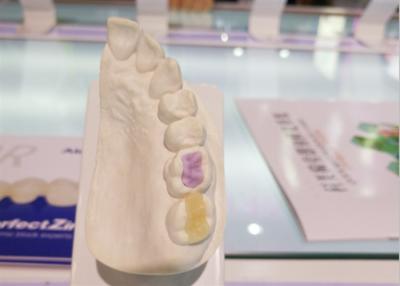 China Custom High-Density Custom Dental Ceramics FDA All-Ceramic Crown for sale