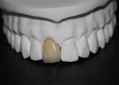 Cina Corona dentaria della porcellana del Cr di Co in vendita