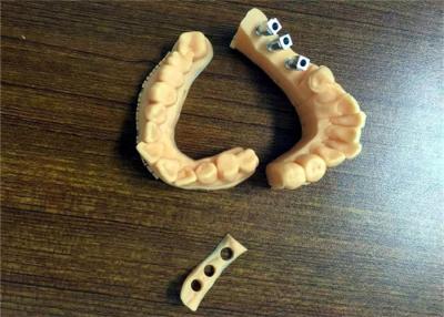 Cina FDA 3D ha stampato la porcellana dentaria della corona dei modelli dentari fusa a metallo in vendita