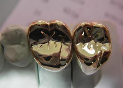 Cina Corona ad alta resistenza del metallo prezioso dei semi del dente della corona del metallo di FMC in vendita