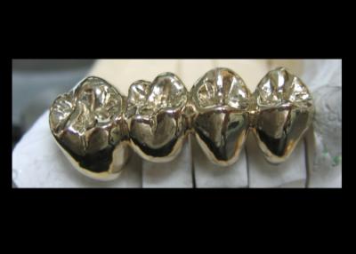 Cina Ultra duro l'OEM che lucida il ponte dentario della corona macchia resistente in vendita