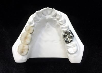 Cina Alta densità dentaria di sicurezza di salute della corona della porcellana ultra dura di Digital in vendita