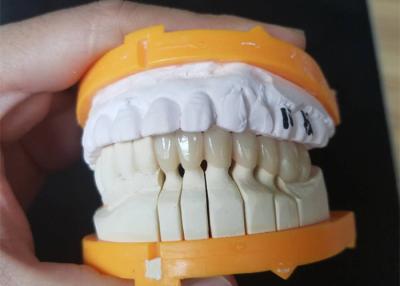 Cina Corone ceramiche su ordinazione di dimensione PFM per i denti posteriori ed anteriori in vendita