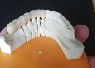 Cina Corone ceramiche su ordinazione di dimensione PFM per i denti posteriori ed anteriori in vendita
