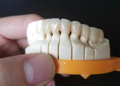 Cina Corone ceramiche su ordinazione di dimensione PFM per i denti posteriori ed anteriori in vendita
