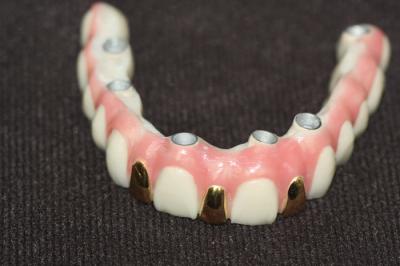 Cina Precisione Digital 3D che stampa il metallo di Antivari dell'impianto dentario basato in vendita