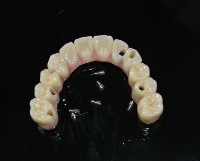 Cina Corona dentale in zirconia: denti di aspetto naturale, durevoli e sicuri in vendita