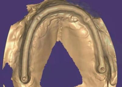 Cina Corona dentale in zirconia: denti di aspetto naturale, durevoli e sicuri in vendita
