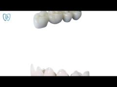 0.3MM Wittende Ceramische Tandkroon om Ongezonde Tanden te vervangen
