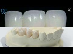 Лаборатория естественного Denture OEM модели цифров зубоврачебного поверхностного резинового ровного зубоврачебная