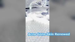 Freeze Dried Acne Powder For Clear Skin