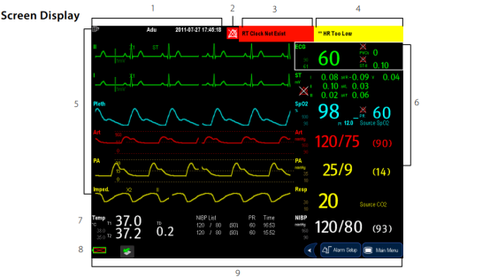 Mindray IPM10 Patient Monitor display screen interface layout