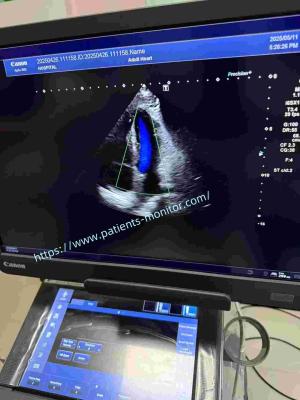 China Toshiba PSI-30BX Phased Array Transducer a used medical ultrasound device with a milky-white exterior and Real-Time Grating Lobe Suppression for sale
