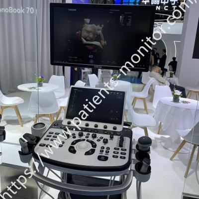 China CHISON XBit 90 Color Doppler Ultrasound System – High-End Full-Body Smart Trolley Ultrasound for sale