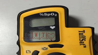 China Dual IBP SPO2 Datex Ohmeda Used Patient Monitor Equipment for sale