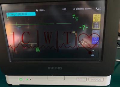 Cina Riparazione del carrello del monitor paziente di PHiliph MX400 in vendita