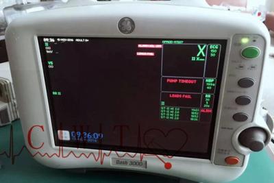 China 12,1 Parameter-Patientenmonitor des Zoll-5, des Gesundheitswesen-Dash3000 Hand der Überwachungsanlage-zweite zu verkaufen