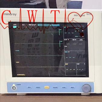 중국 Mec 1000 비피들 가지고 다닐 수 있는 다중 파라미터 모니터 대체 3 채널 파형 판매용