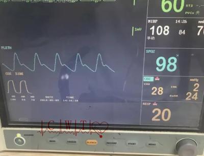Cina ECG Mindray Mec 2000 ha usato il monitor paziente per ICU/adulto in vendita