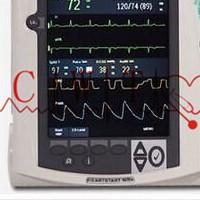 Cina La macchina a 12 pollici del cuore dell'VEA, adulto ha utilizzato la macchina della scossa elettrica per cuore in vendita