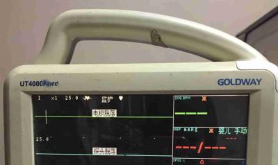 Cina Goldway UT4000Apro ha usato il monitor paziente con l'esposizione a 12,1 pollici di TFT in vendita