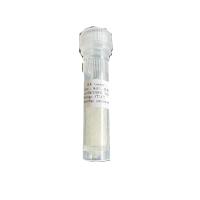 China CEA Real Time PCR Kit 25 Tests High Accuracy Tumor Marker Detection for sale