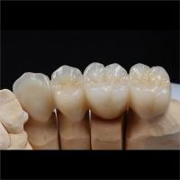 Quality Dental PFM Crown And Bridge for sale
