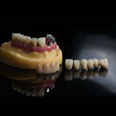 Cina Materiale per corone dentali PFM in porcellana ceramica per il restauro in vendita