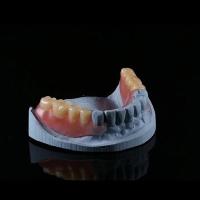 China Lightweight Flexible Valplast Partial Denture For Single Tooth for sale